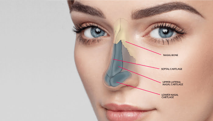Most Common Rhinoplasty Techniques - Dr Rodrigo Teixeira